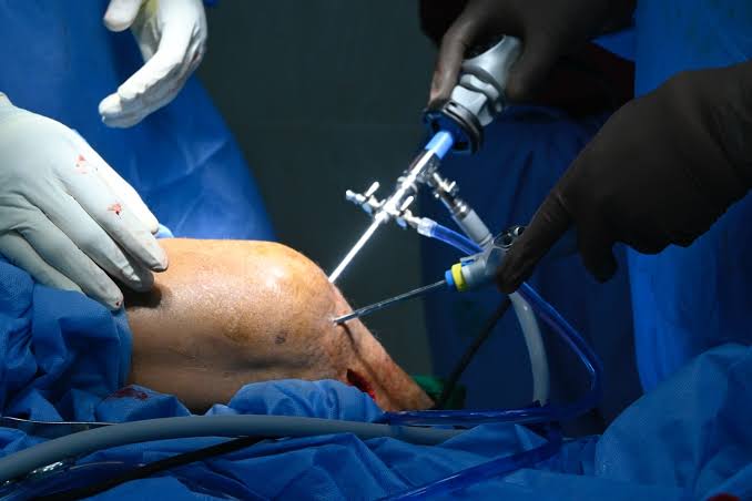 Choosing Orthopaedics: Dr. Ezekiel Oburu's Story - mTV